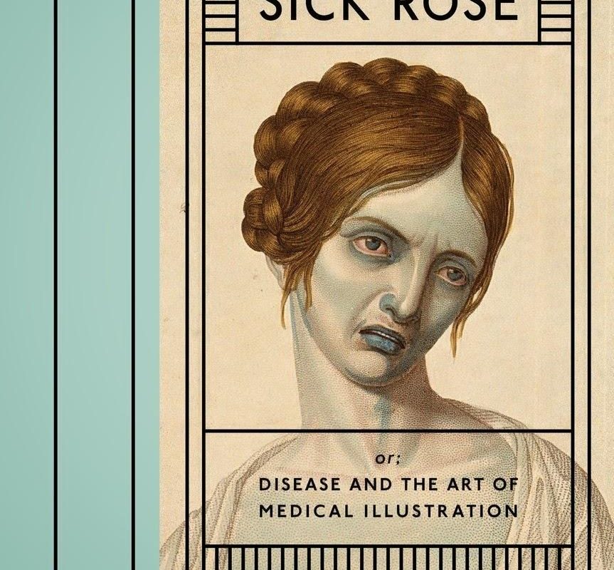 Rosa Doente: As grotescas ilustrações médicas – Fatos Desconhecidos