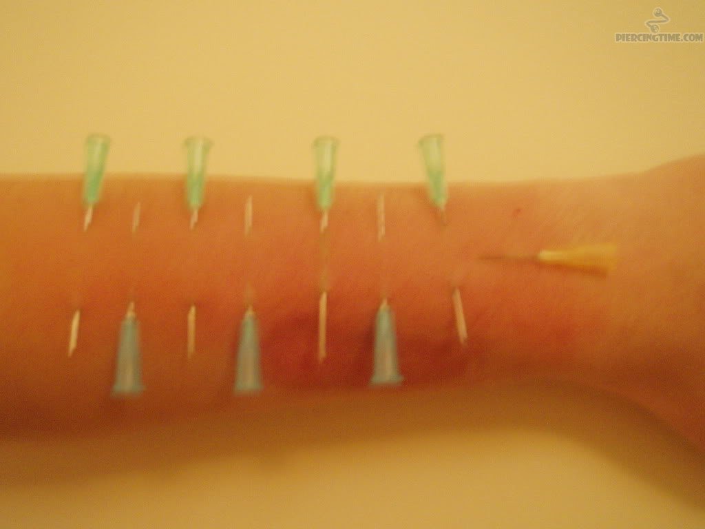 Injeções: quais os tipos, as agulhas e o que faz elas doerem ...