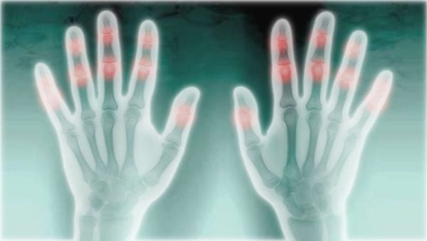 Descubra o que acontece quando você estala seus dedos! – Fatos ...