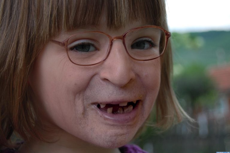 8 sinais de que você é feio e não reparou – Fatos Desconhecidos