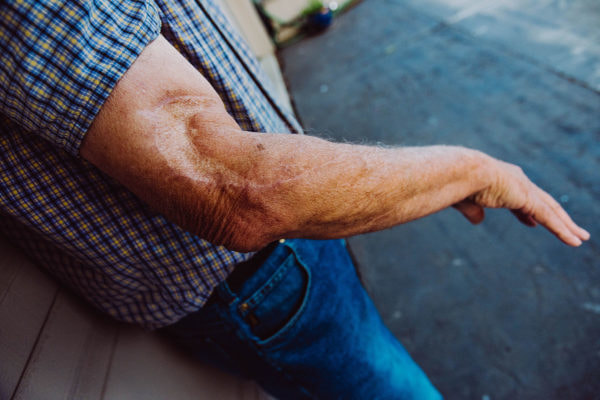 8 histórias perturbadoras de pessoas que enfrentaram animais selvagens ...