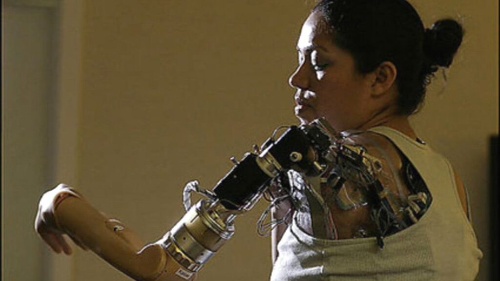 7 cyborgs que incrivelmente já existem – Fatos Desconhecidos