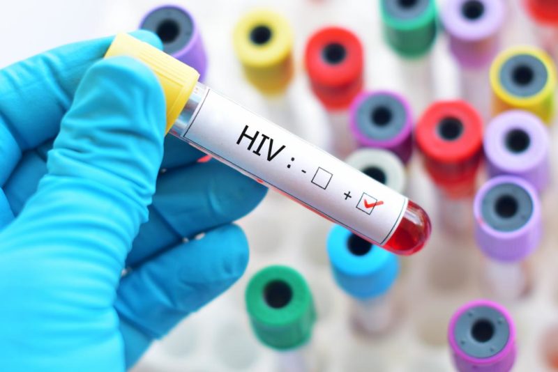 Como funciona o novo tipo de HIV recém descoberto? – Fatos Desconhecidos