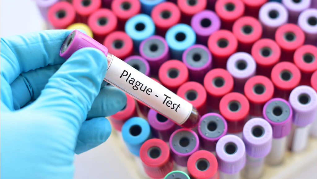 Califórnia tem seu primeiro caso de peste humana em 5 anos – Fatos ...