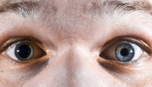 O ser humano consegue mudar o tamanho da pupila quando preciso. Coisa ...