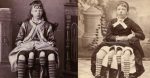Conheça Myrtle Corbin, a mulher que tinha 4 pernas